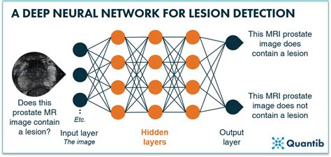 Deep Learning Radiology The Secret Of Convolutional Neural Networks