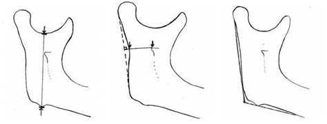 vertical measurement a horizontal measurement b and