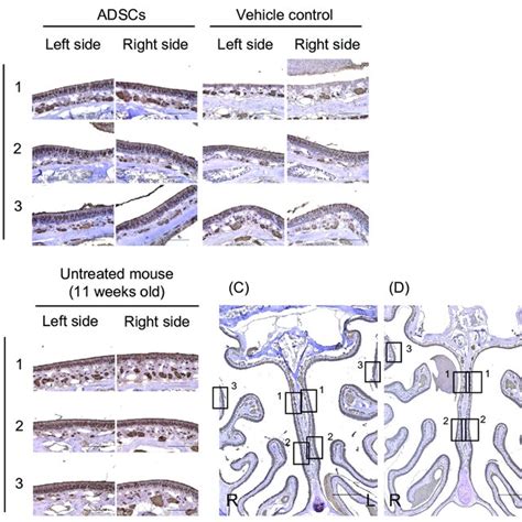 Immunohistochemical Analysis Of Olfactory Marker Protein In The Nasal