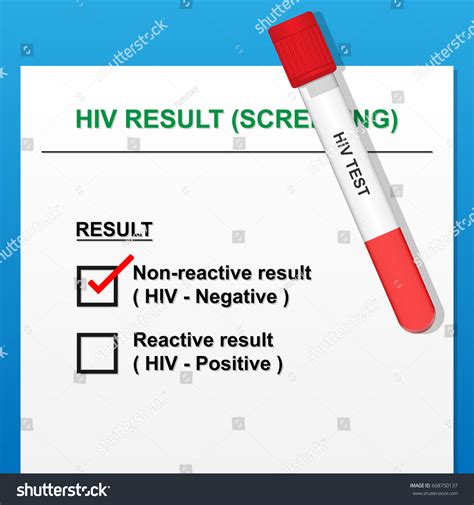 Hiv Test Result Vacutainer Contain Lab Stock Vector Royalty Free