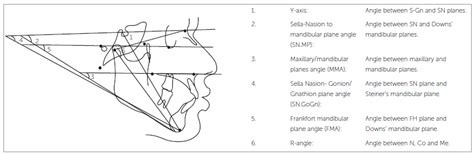 diagnostic performance of various cephalometric parameters