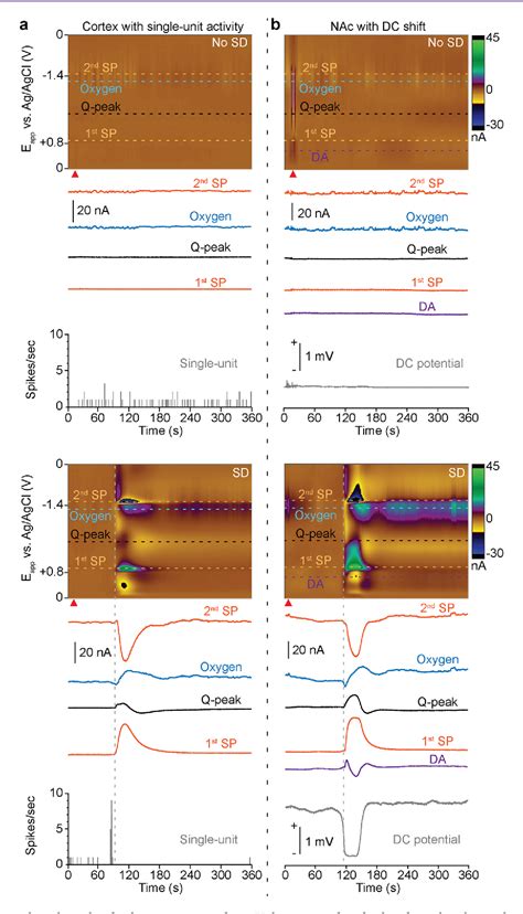 Figure 1 From Comparison Of Spreading Depolarizations In The Motor