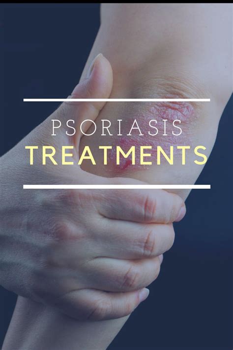 Psoriasis Is A Chronic Inflammatory Autoimmune Skin Disease Affecting 2