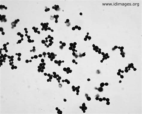 Infectious Disease Images Emicrobes Digital Library Images
