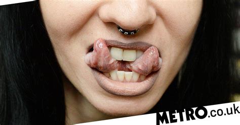 people who get their tongues split are putting their lives at risk