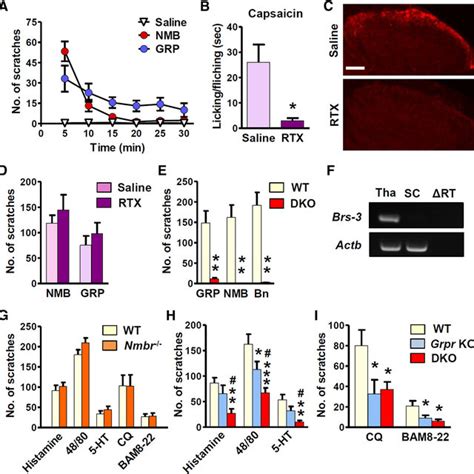 Nmbr And Grpr Expression In The Dorsal Horn Of The Spinal Cord A F