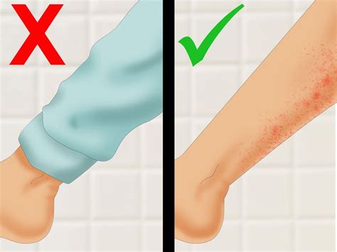 4 Ways To Get Rid Of Razor Burn Fast Wikihow Razor Burns Razor
