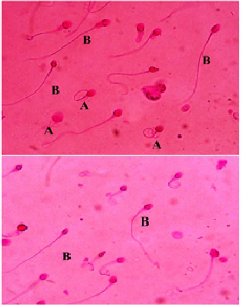 Response Of Spermatozoa For Hypo Osmotic Swelling Hos Test A