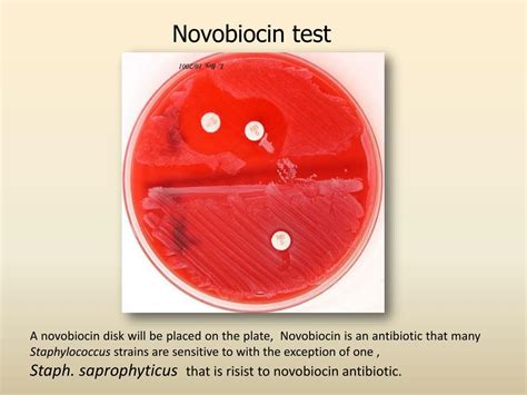 Ppt Isolation And Identification Of Staphylococci Powerpoint