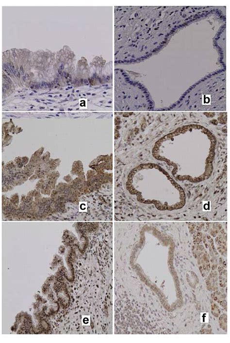Immunohistochemical Expression Of Sex Steroid Hormone Receptors Cell
