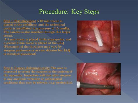 Ppt Laparoscopic Appendectomy Powerpoint Presentation Free Download