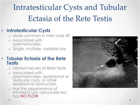 Ppt Scrotal Ultrasound Powerpoint Presentation Id 5671926