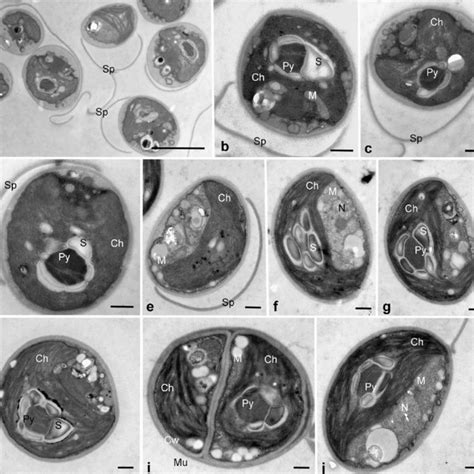 Transmission Electron Micrographs Of Vegetative Cells Of Xerochlorella
