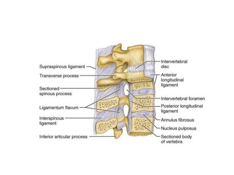 Ossification Of Posterior Longitudinal Ligament
