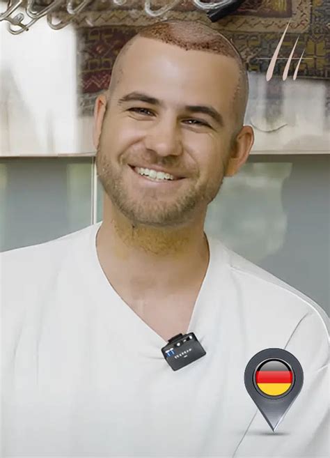 Haartransplantation Türkei Istanbul Dr Serkan Aygin Clinic