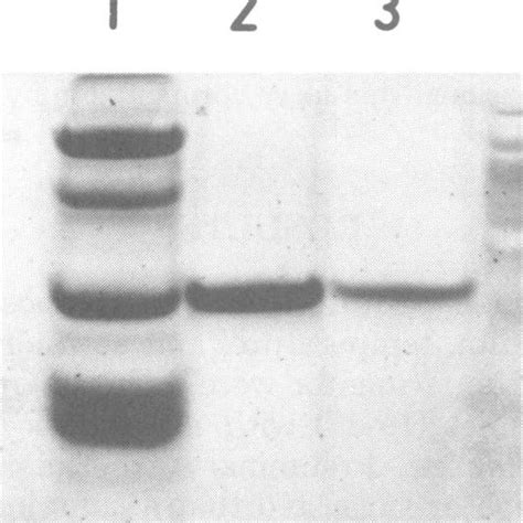 Sds Polyacrylamide Gel Electropherogram Of Xylanase A 1 Protein