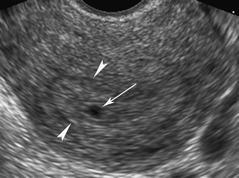 Obstetric Ultrasound Radiology Key