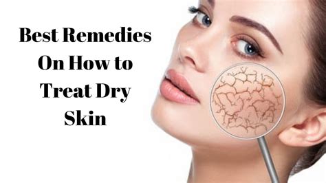 Dry Skin With Large Pores The Complete Guide To Get Rid Of It The