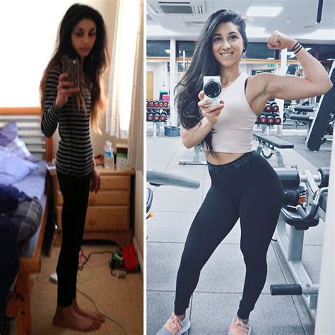 Anorexia Before And After Amazing Before And After Photos Of Anorexia
