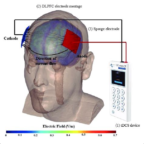 Transcranial Direct Current Stimulation Tdcs Equipment Working