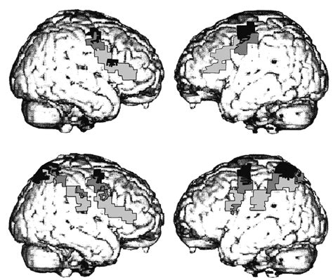Mirror Neuron System In Humans Somatotopic Fmri Activations In