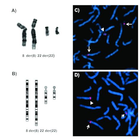 Array Comparative Genome Hybridization Profiles Of The Chromosomes