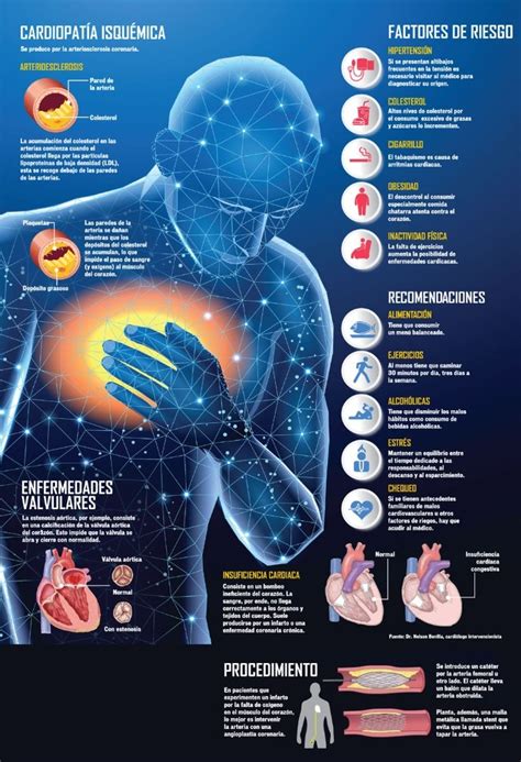 Así Se Siente Un Ataque Cardíaco La Prensa Gráfica