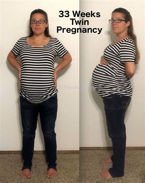 30 Weeks Pregnant With Twins All You Need Infos