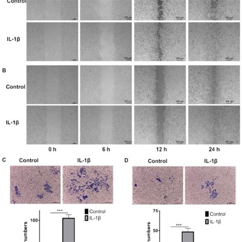 Il 1β Stimulation Enhances The Migration And Invasion Of Hnscc And