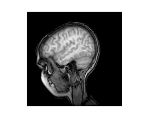pylab examples example code mri demo py — matplotlib 1 5 3 documentation