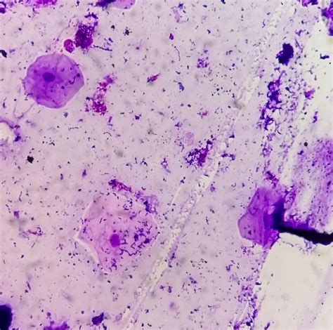 Premium Photo Gram Stain Of High Vaginal Swab Photomicrograph