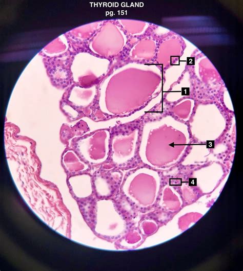 Thyroid Gland Under Microscope