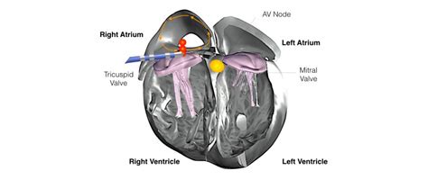 atrial flutter ablation one heart cardiology