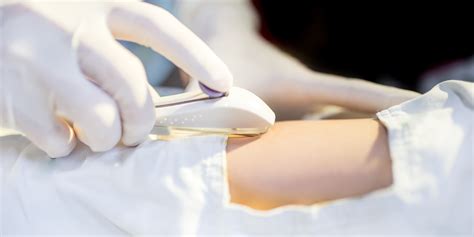 how effective is nexplanon raleigh gynecology and wellness