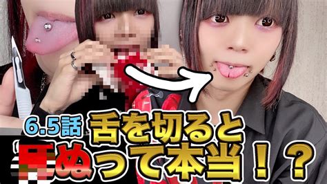 【その後】舌を切ると ぬって本当？スプタン経過報告。 Youtube