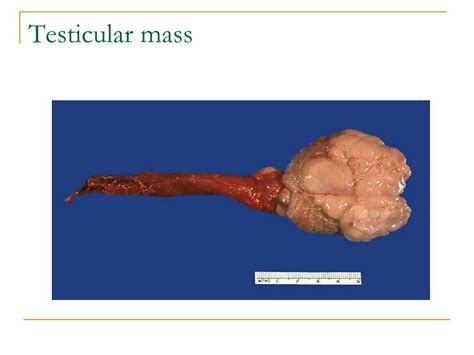 Ppt Testicular Diseases Powerpoint Presentation Free Download Id