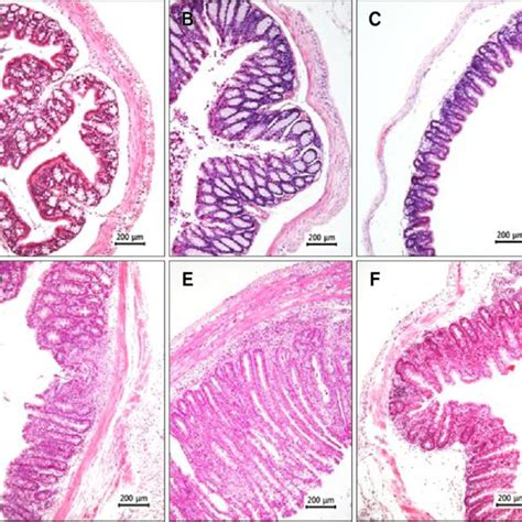 Spontaneous Contractility Of The Proximal A And Distal B Colon In