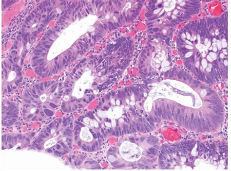Colon Abdominal Key