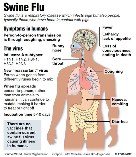 Prevention And Home Remedies Of Swine Flu H1n1