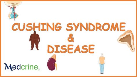 Cushing Syndrome Causes Pathophysiology Symptoms And Treatment 16740