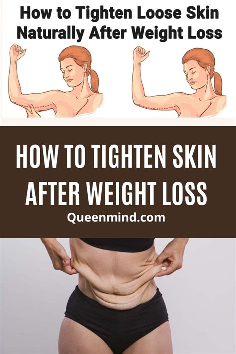 10 Ways To Naturally Tighten Skin After Weight Loss Artofit