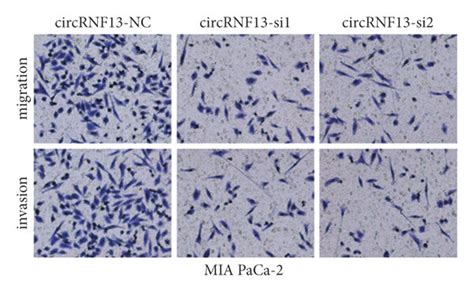 Circrnf13 Knockdown Inhibits Pancreatic Cancer Cell Proliferation And