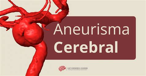 Aneurismas Cerebrais O Que é Causa Sintomas E Tratamentos