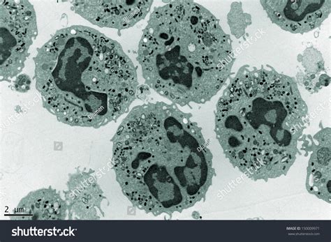 Electron Microscopy Photography Group Human Neutrophils Stockfoto Nu