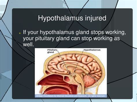 Ppt Hypothalamus Powerpoint Presentation Free Download Id 9696079