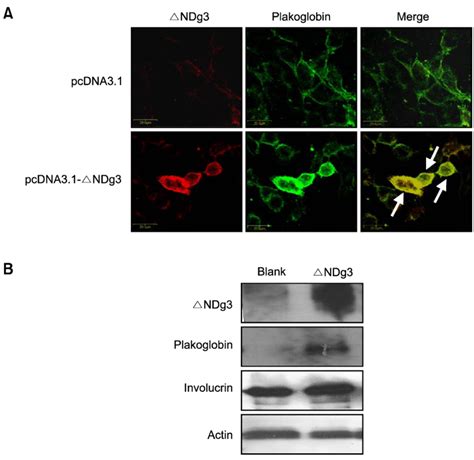 Plakoglobin And Δndg3 Expression In Hacat Cells A Cells Were