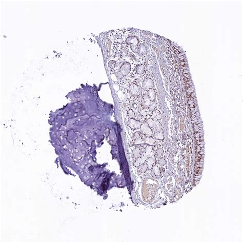 Tissue Expression Of Procr Staining In Bronchus The Human Protein Atlas