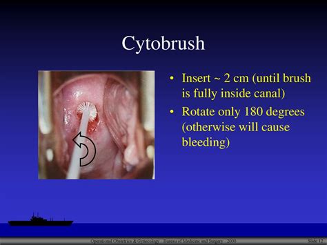 Pap Smear Technique Video Ppt Download
