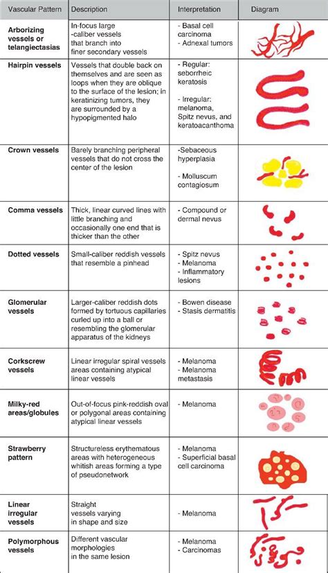 Vascular Patterns In Dermoscopy Basal Cell Carcinoma Vascular