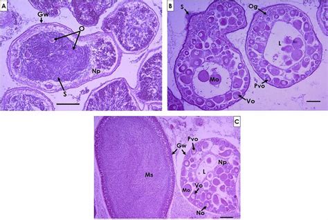 Gonad Section Of Specimens With The Presence Of Hermaphroditism A